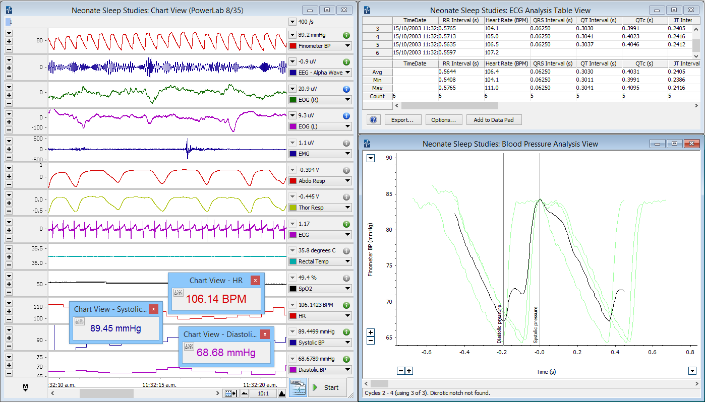 Measure and analyze multiple signals in sleep studies
