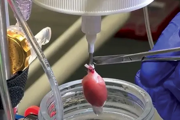 Isolated Heart Perfusion Systems | Crystalloid, Whole-blood ...