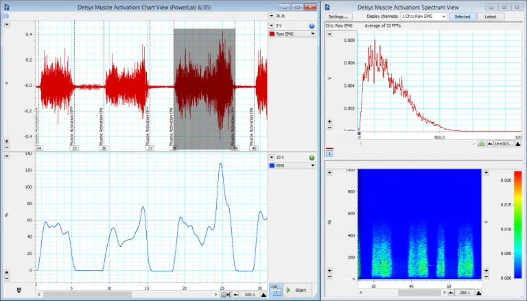Wired Physiological Monitoring | ADInstruments