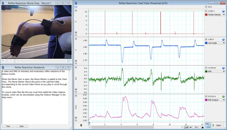 Wired Physiological Monitoring | ADInstruments
