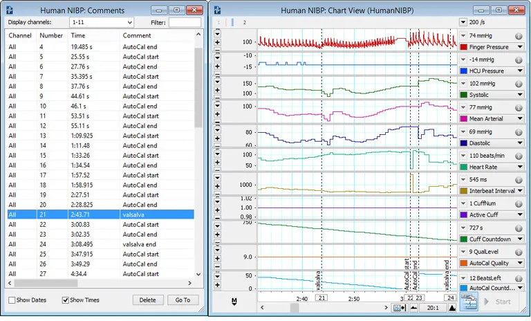 Human Non-invasive Blood Pressure (NIBP) | ADInstruments