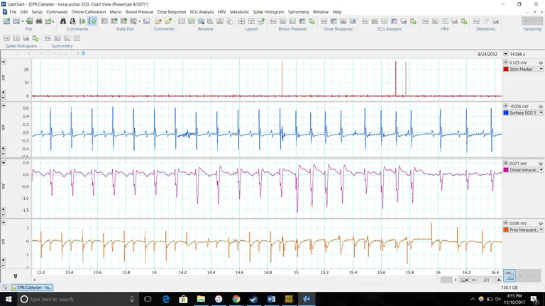Intracardiac ECG | ADInstruments