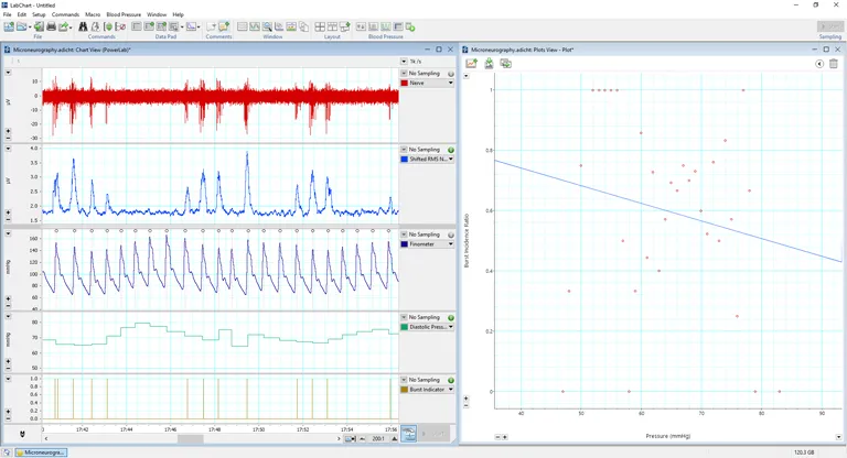 Microneurography | Nerve Activity Measurement | ADInstruments