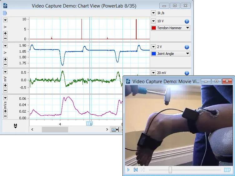 Video Capture | ADInstruments
