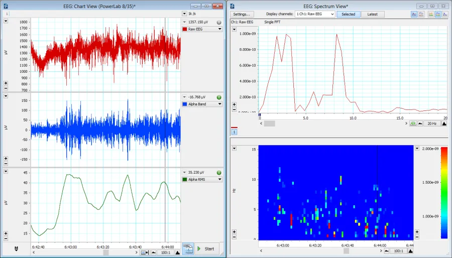 Electroencephalography (EEG) Analysis & Measurement | ADI