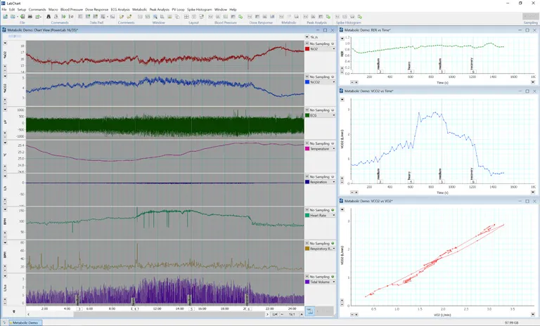 Temperature | ADInstruments