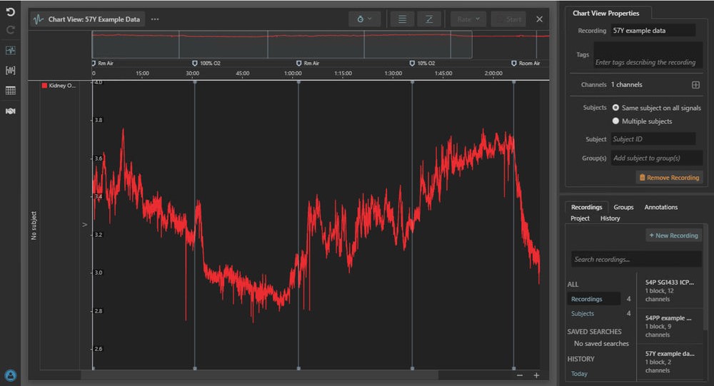 Five Unique Neuroscience Applications Using Telemetry