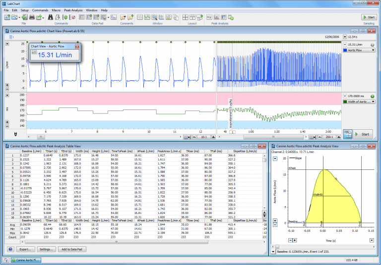 Invasive Blood Flow | ADInstruments