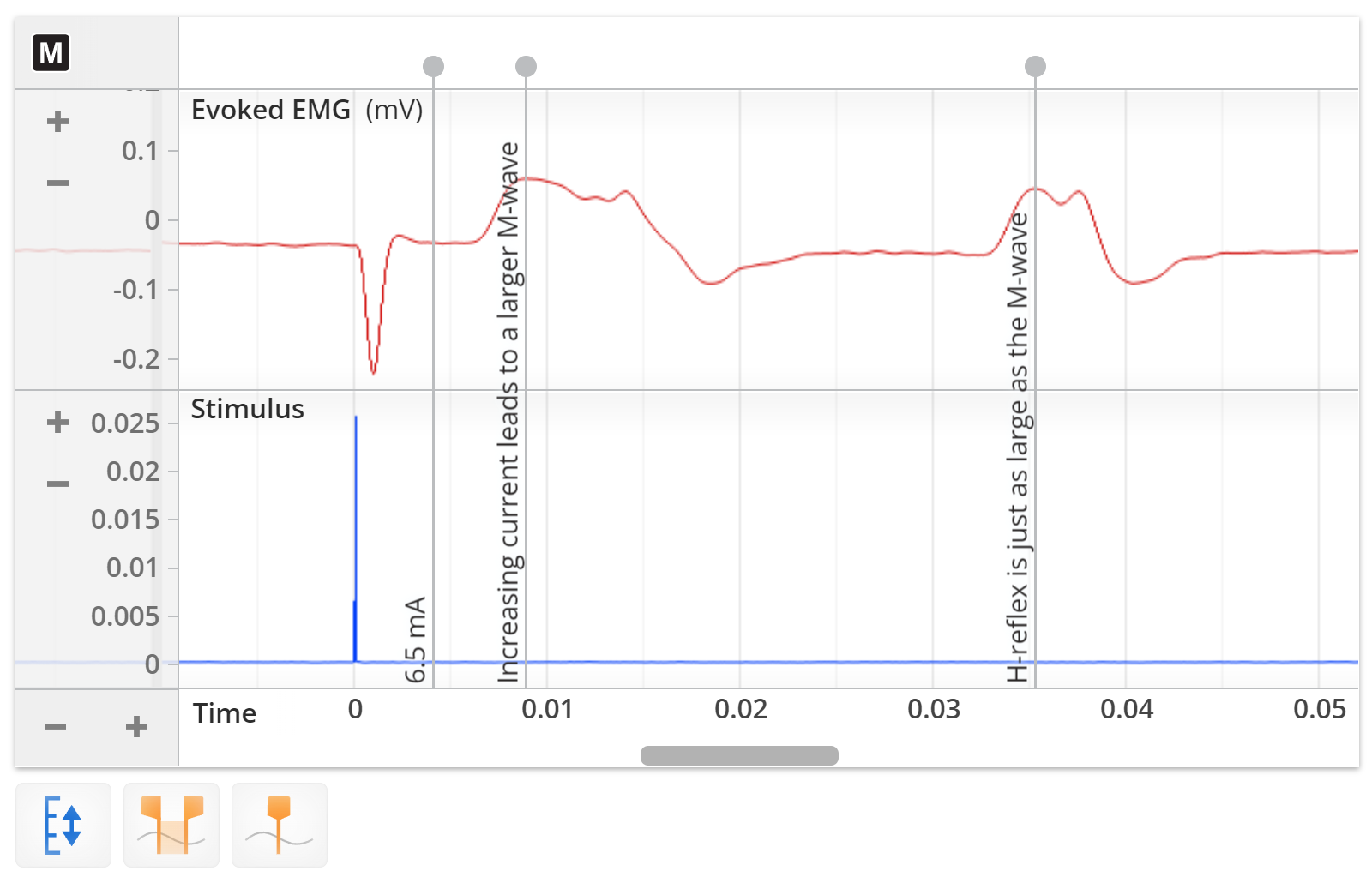 New for physiology educators: Take a look inside our Hoffmann’s Reflex ...
