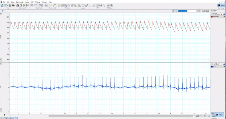 Surgical Instruction: Left Ventricular Pressure via Carotid in Mouse ...