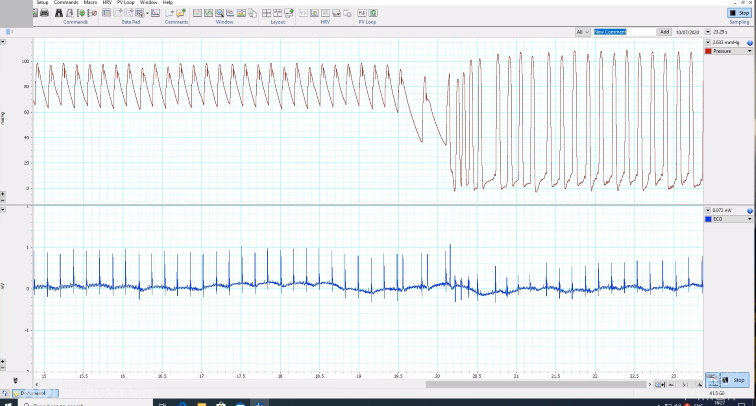 Surgical Instruction: Left Ventricular Pressure via Carotid in Mouse ...