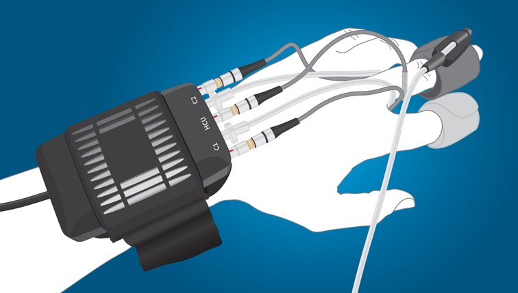 Bigger isn't always better: Introducing the new Human NIBP Nano | ADInstruments
