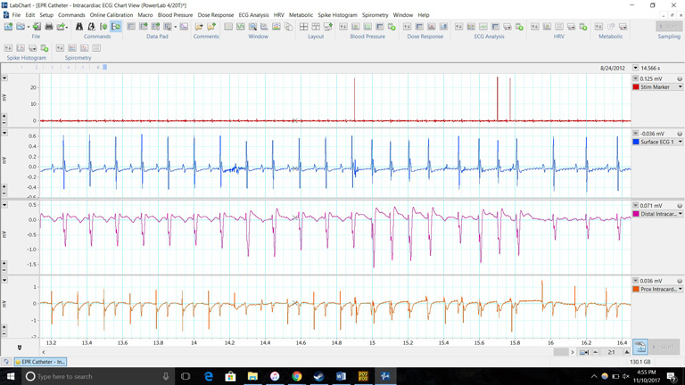 Intracardiac ECG | ADInstruments