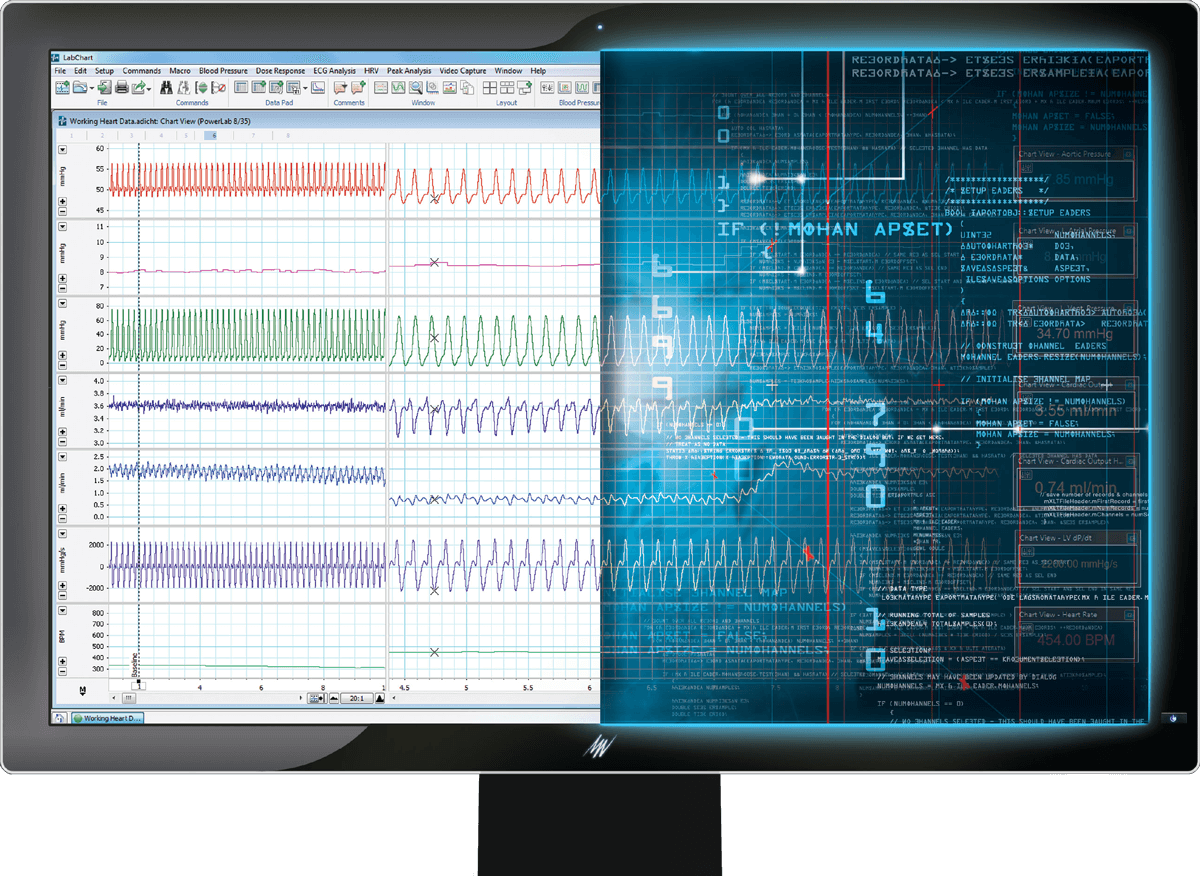 LabChart - Life Science Data Acquisition Software | Data Analysis
